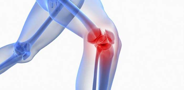 All About Knee Osteoarthritis Stages And Symptoms It Zem Solutions